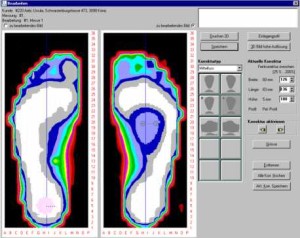 Brisbane orthotics foot scan – Podiatrist Brisbane Southside | The ...