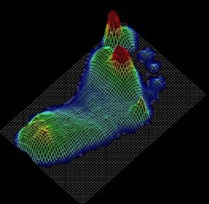 Elementor #167 – Podiatrist Brisbane Southside | The Podiatry Practice | Orthotics, Ingrown Toenails
